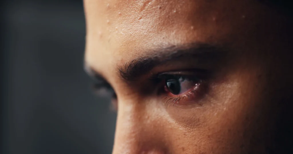 How To Know What Someone's Eyes on Meth Look Like